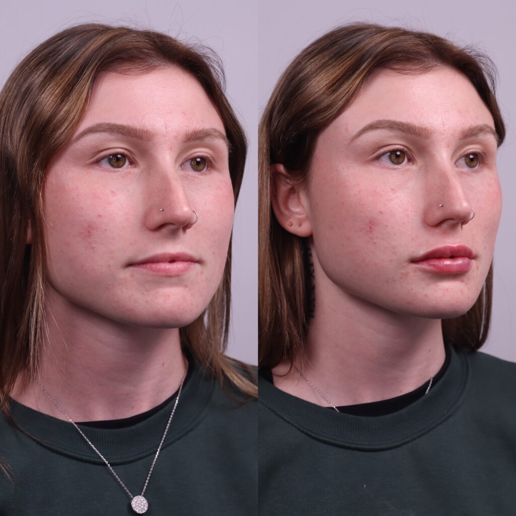Cosmetic Doctor Brisbane Leading Non Surgical Cosmetic Clinics In Brisbane